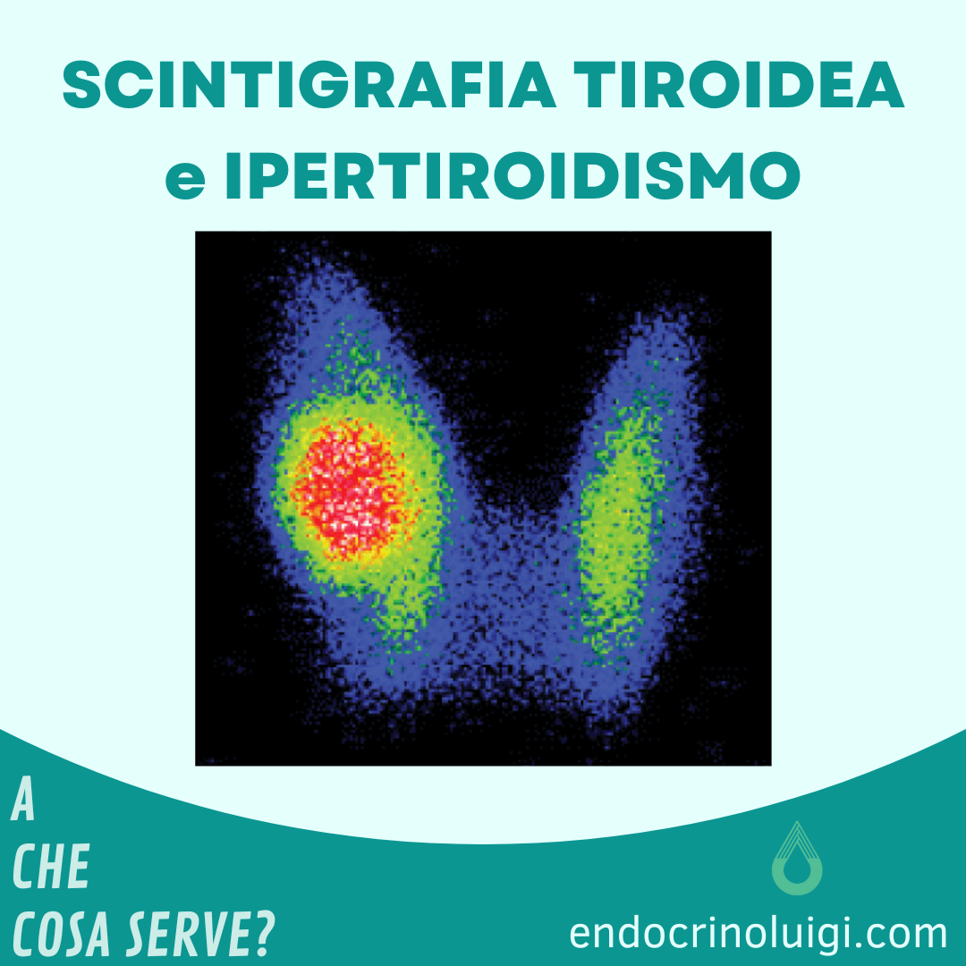 Scintigrafia tiroidea e ipertiroidismo – Endocrinoluigi